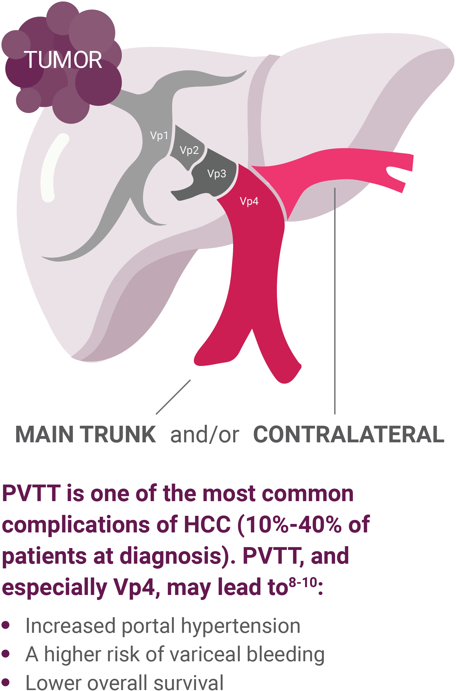 IMbrave150 Exploratory Analysis - Vp4 | TECENTRIQ® (atezolizumab)