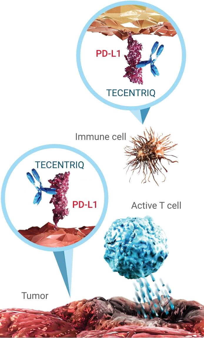 TECENTRIQ® (atezolizumab) proposed mechanism of action | HCC